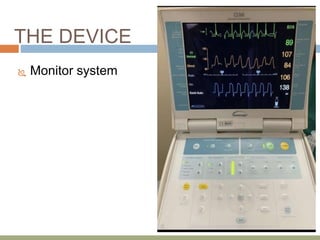 IABP- intra Aortic Balloon Pump | PPTX