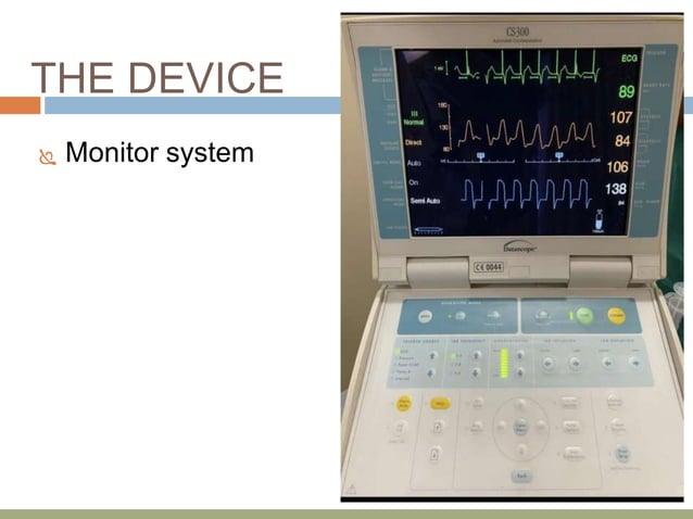 IABP- intra Aortic Balloon Pump | PPTX