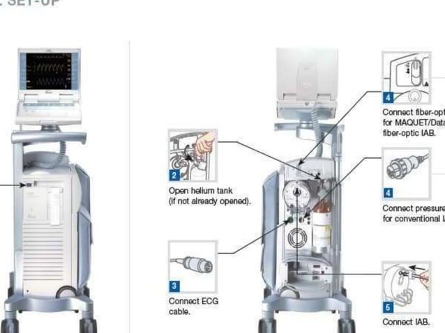 IABP- intra Aortic Balloon Pump | PPTX