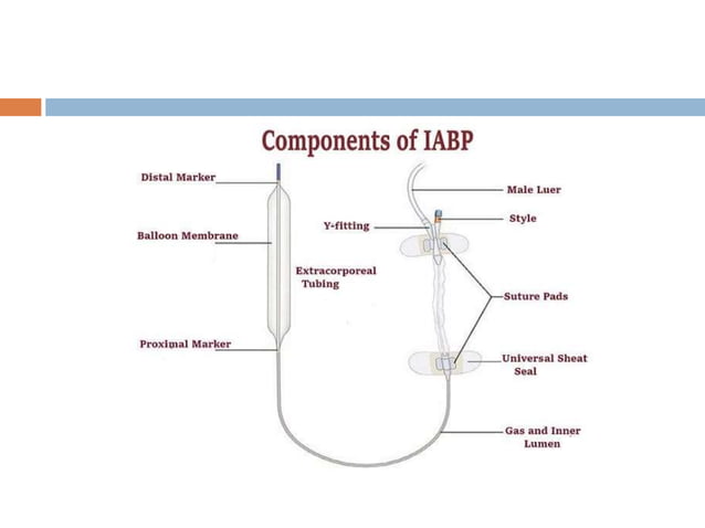 IABP- intra Aortic Balloon Pump | PPTX