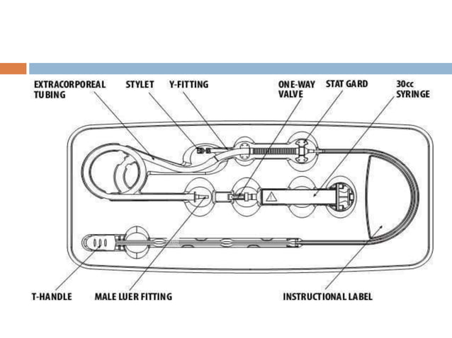 IABP- intra Aortic Balloon Pump | PPTX