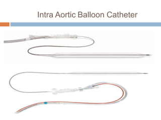 IABP- intra Aortic Balloon Pump | PPTX