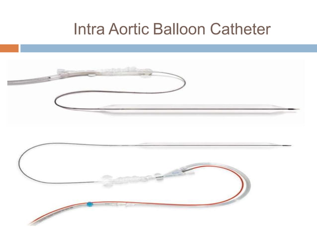IABP- intra Aortic Balloon Pump | PPTX