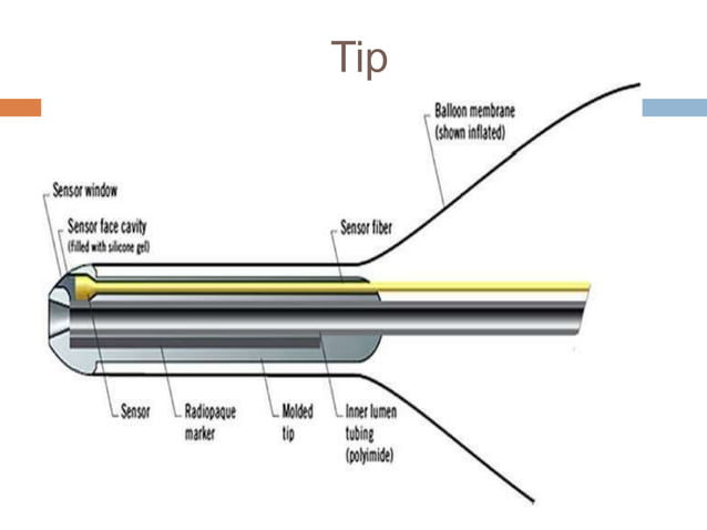 IABP- intra Aortic Balloon Pump | PPTX