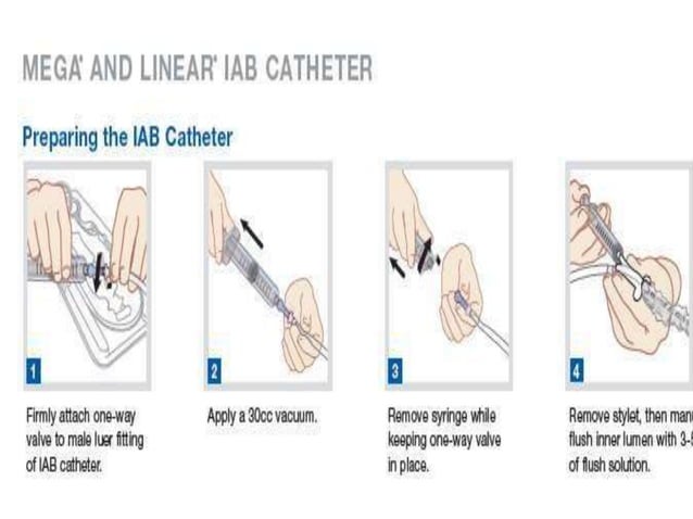 IABP- intra Aortic Balloon Pump | PPTX