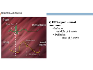 IABP- intra Aortic Balloon Pump | PPTX
