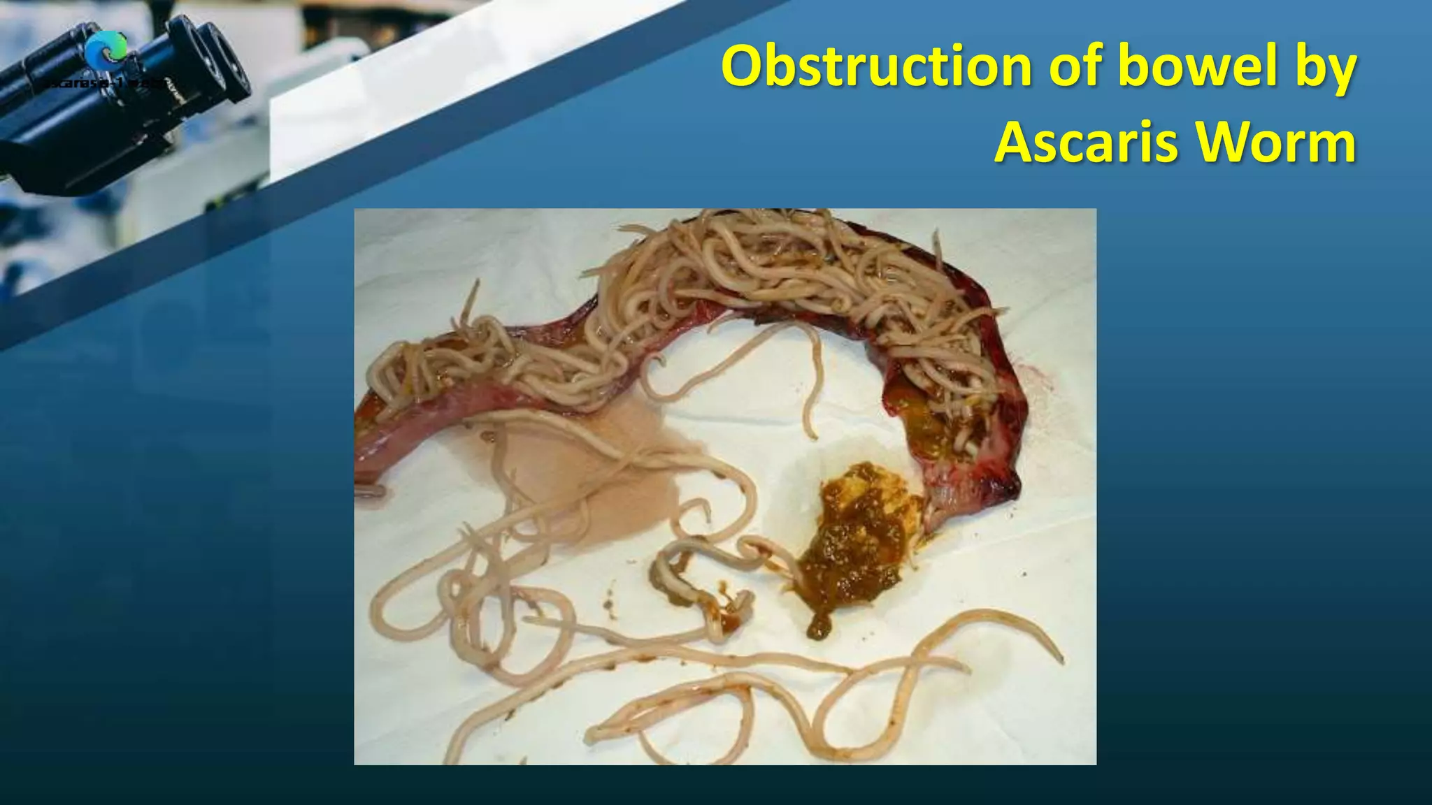 Soil transmitted helminths | PPTX