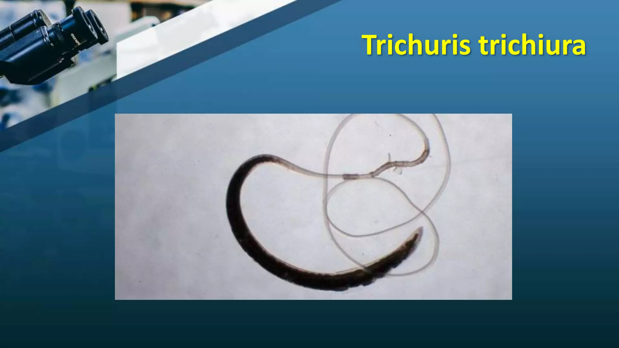 Soil transmitted helminths | PPTX