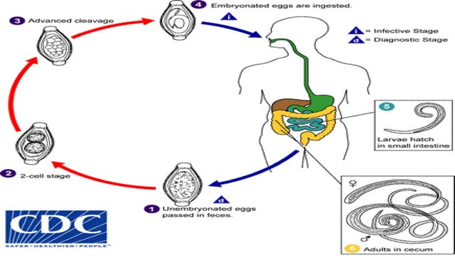 Soil transmitted helminths | PPTX | Digestive Disorders | Diseases and ...