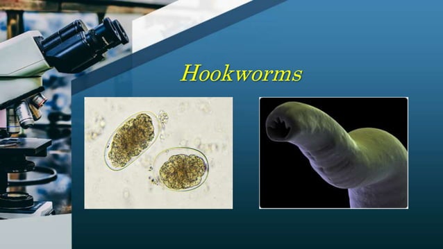 Soil transmitted helminths | PPTX | Digestive Disorders | Diseases and ...