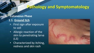 Soil transmitted helminths | PPTX