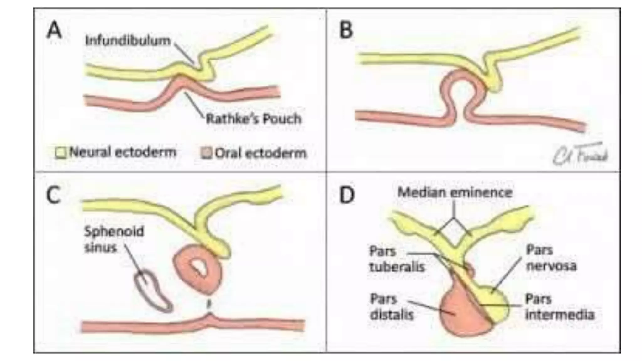 Space occupying lesions | PPTX