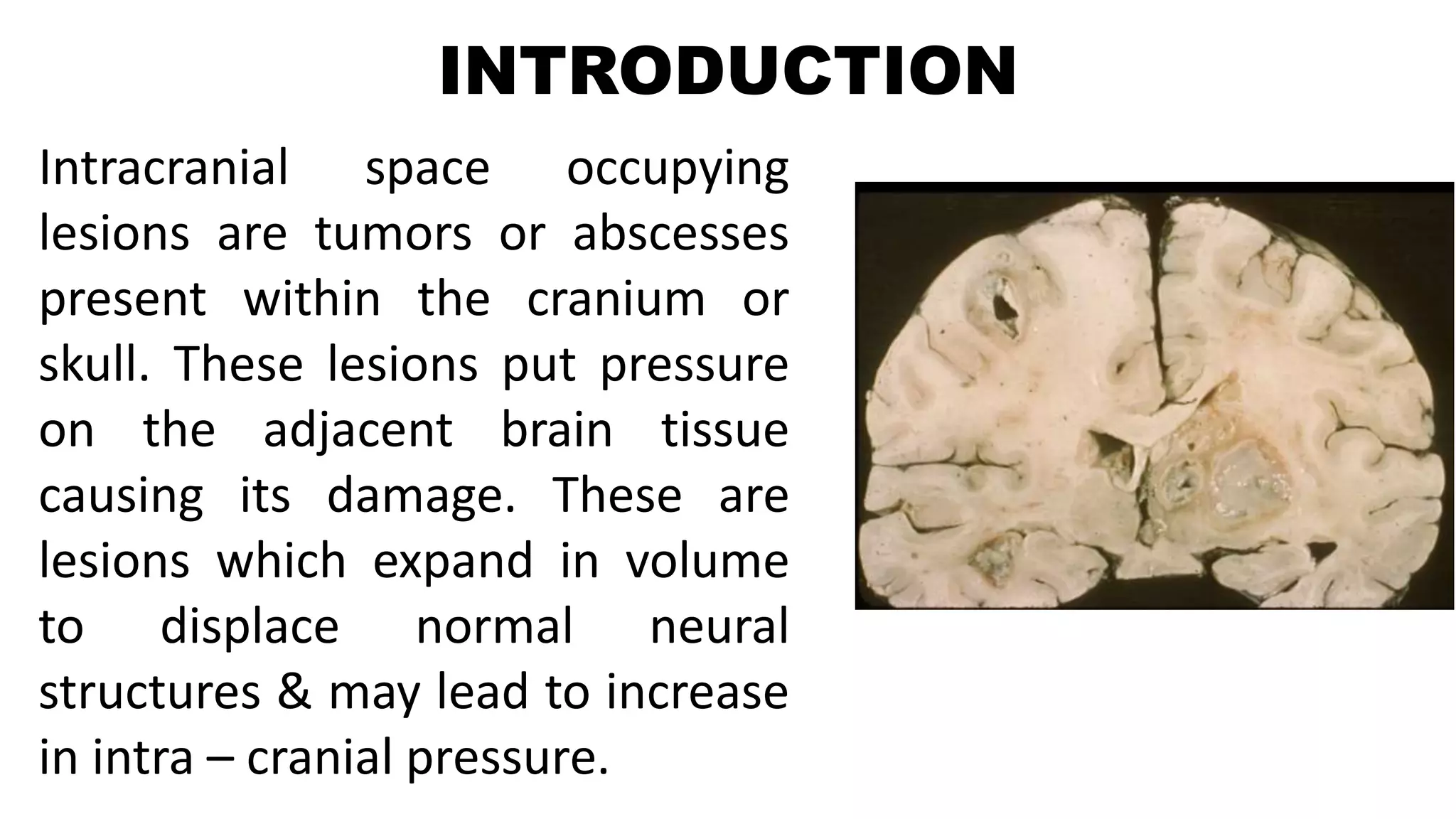 Space occupying lesions | PPTX