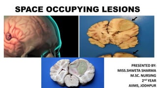 Space occupying lesions | PPTX