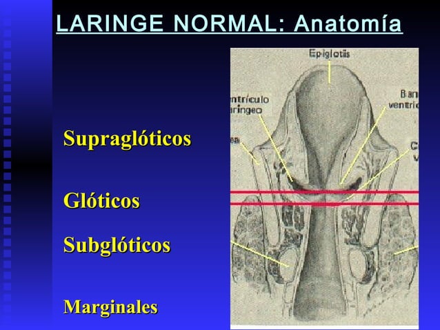 Sindrome obstructivo laringeo agudo | PPT