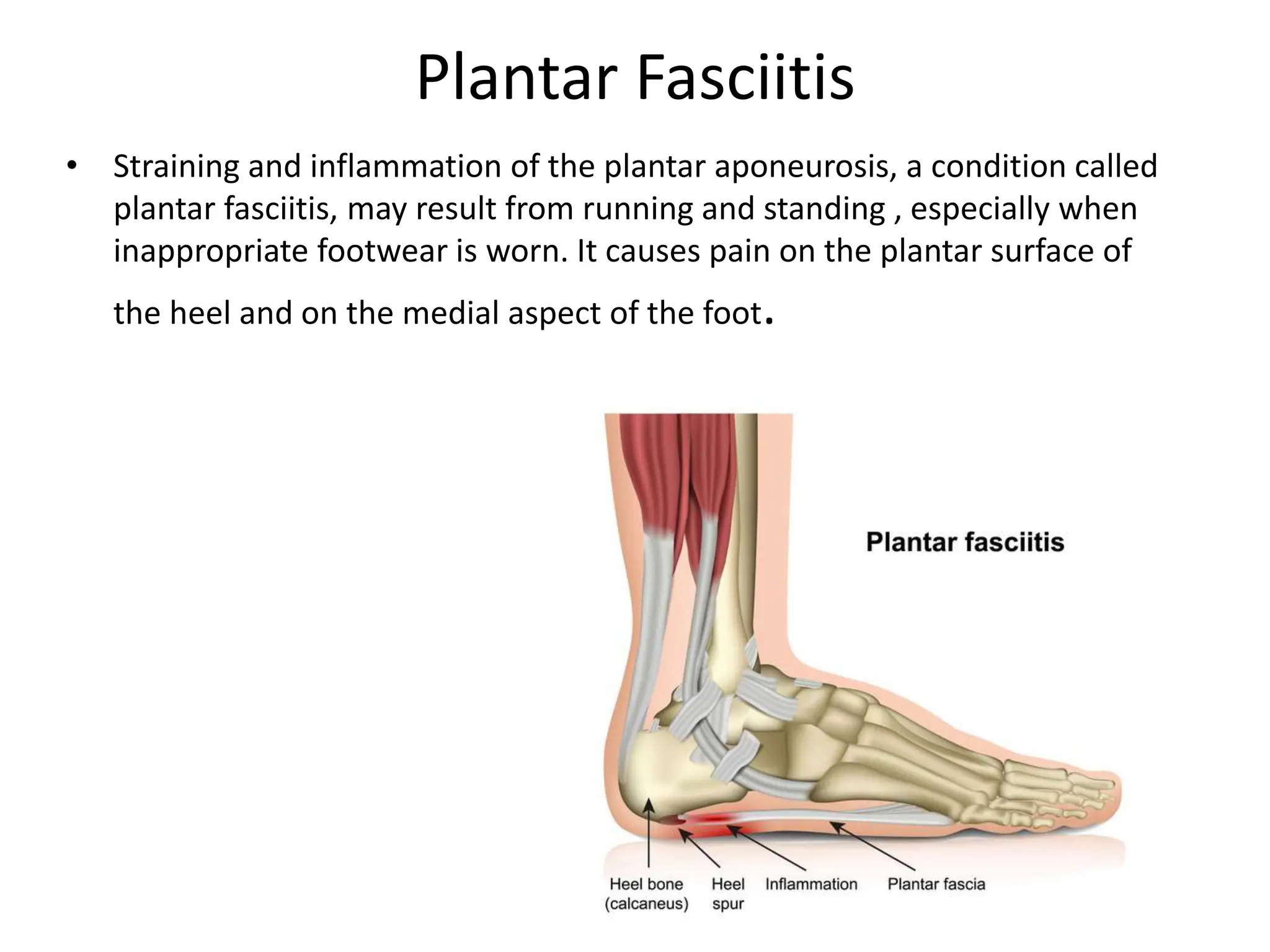 sole of foot.pptx