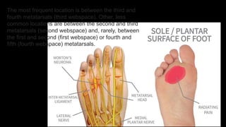 Sole of foot soft tissue and muscles | PPTX