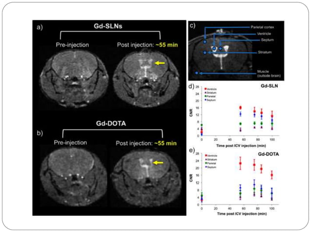 Solid lipid nanoparticle for imaging | PPT