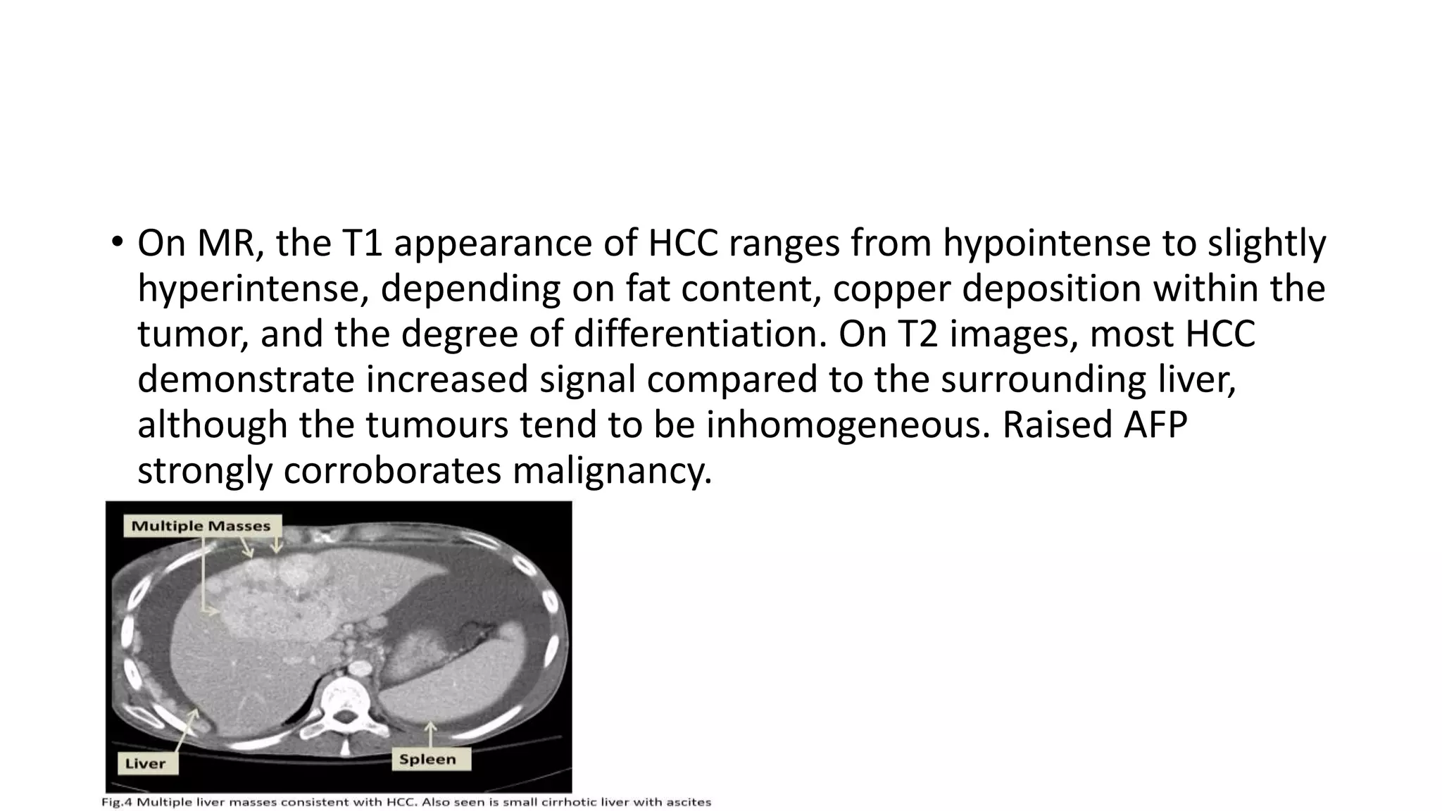 Solid liver SOL | PPTX