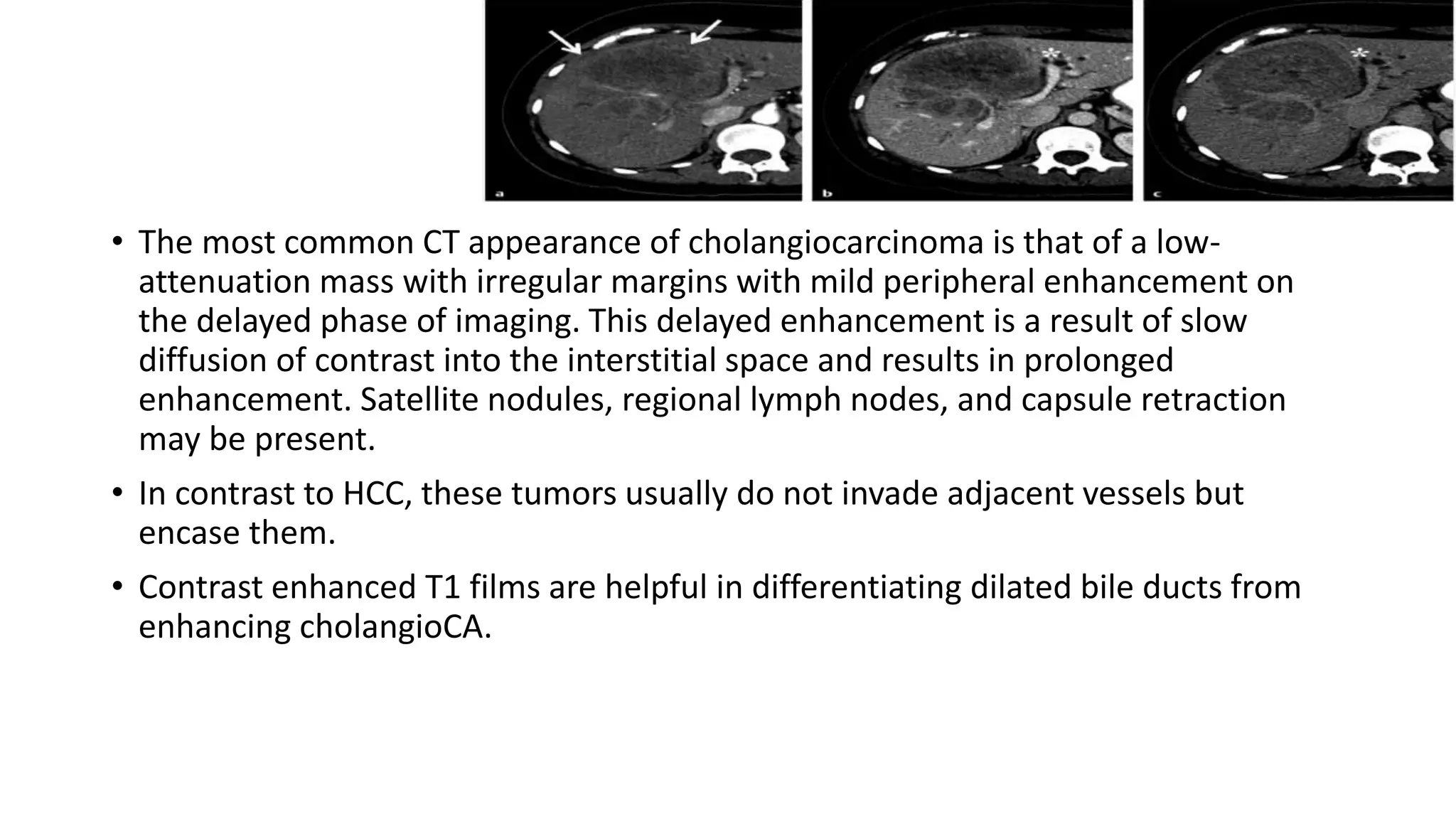 Solid liver SOL | PPTX