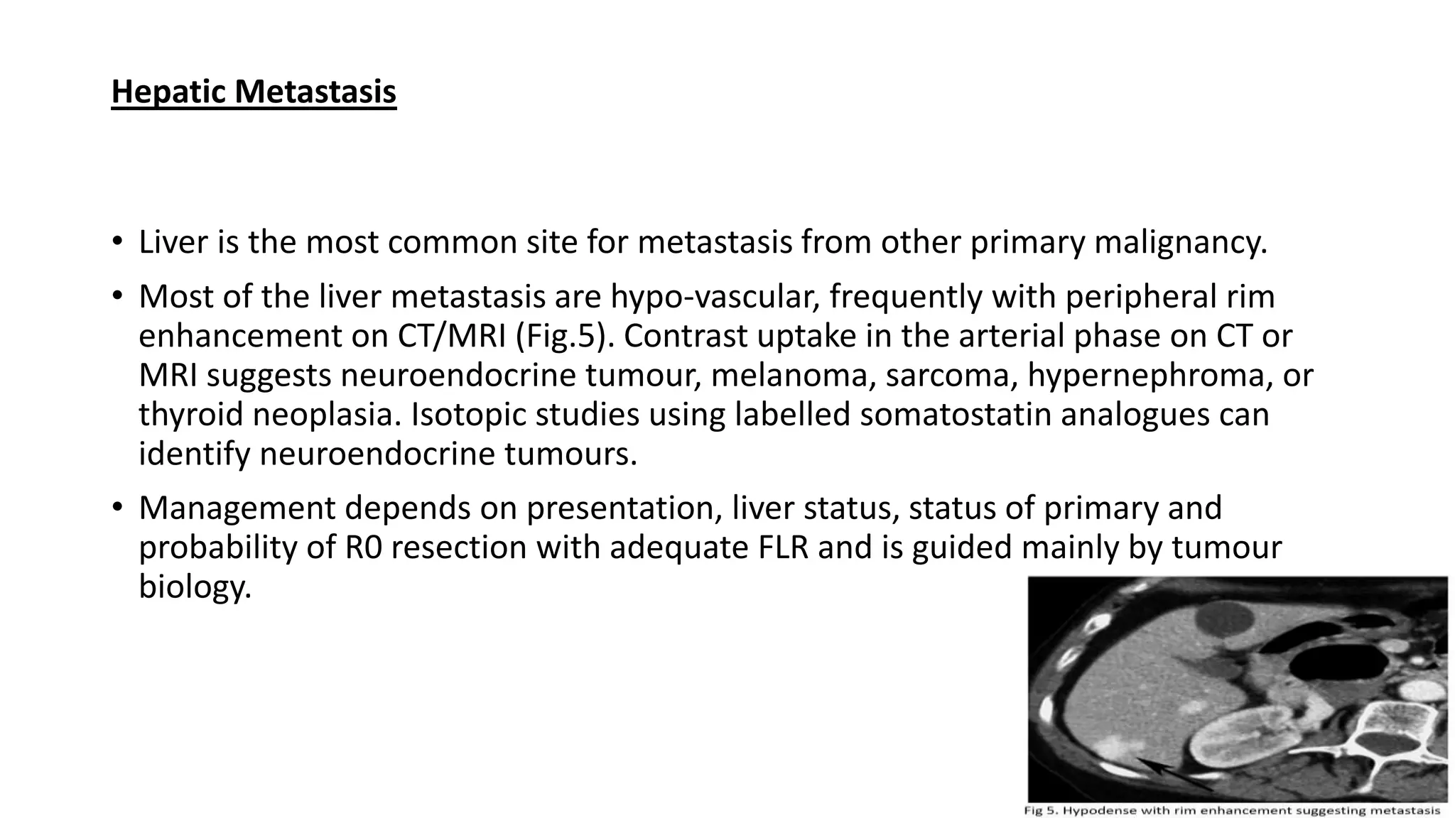 Solid liver SOL | PPTX