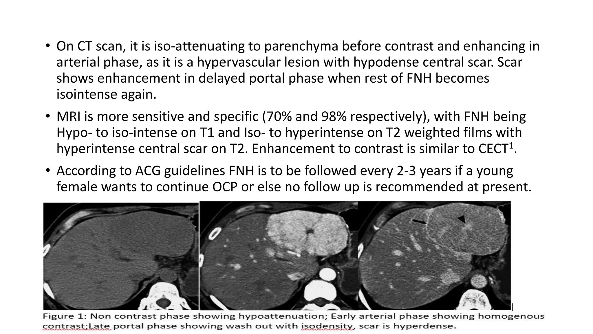 Solid liver SOL | PPTX