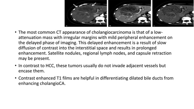 Solid liver SOL | PPTX
