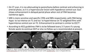 Solid liver SOL | PPTX