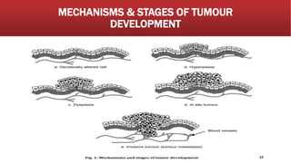 Solid Tumour - Pathogenesis | PPTX