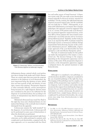 Solitary_cecum_diverticulitis_-_A_surprising_diagn.pdf