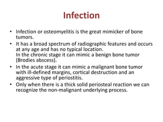 Solitary lytic lesions | PPTX
