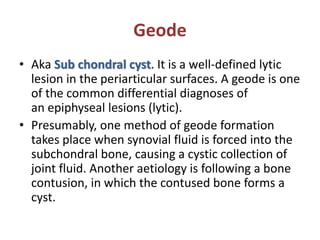 Solitary lytic lesions | PPTX