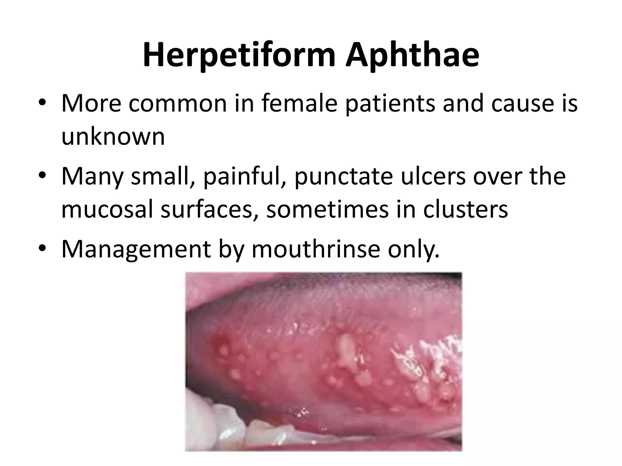 Solitary Oral Ulcers And Systemic Diseases Ppt