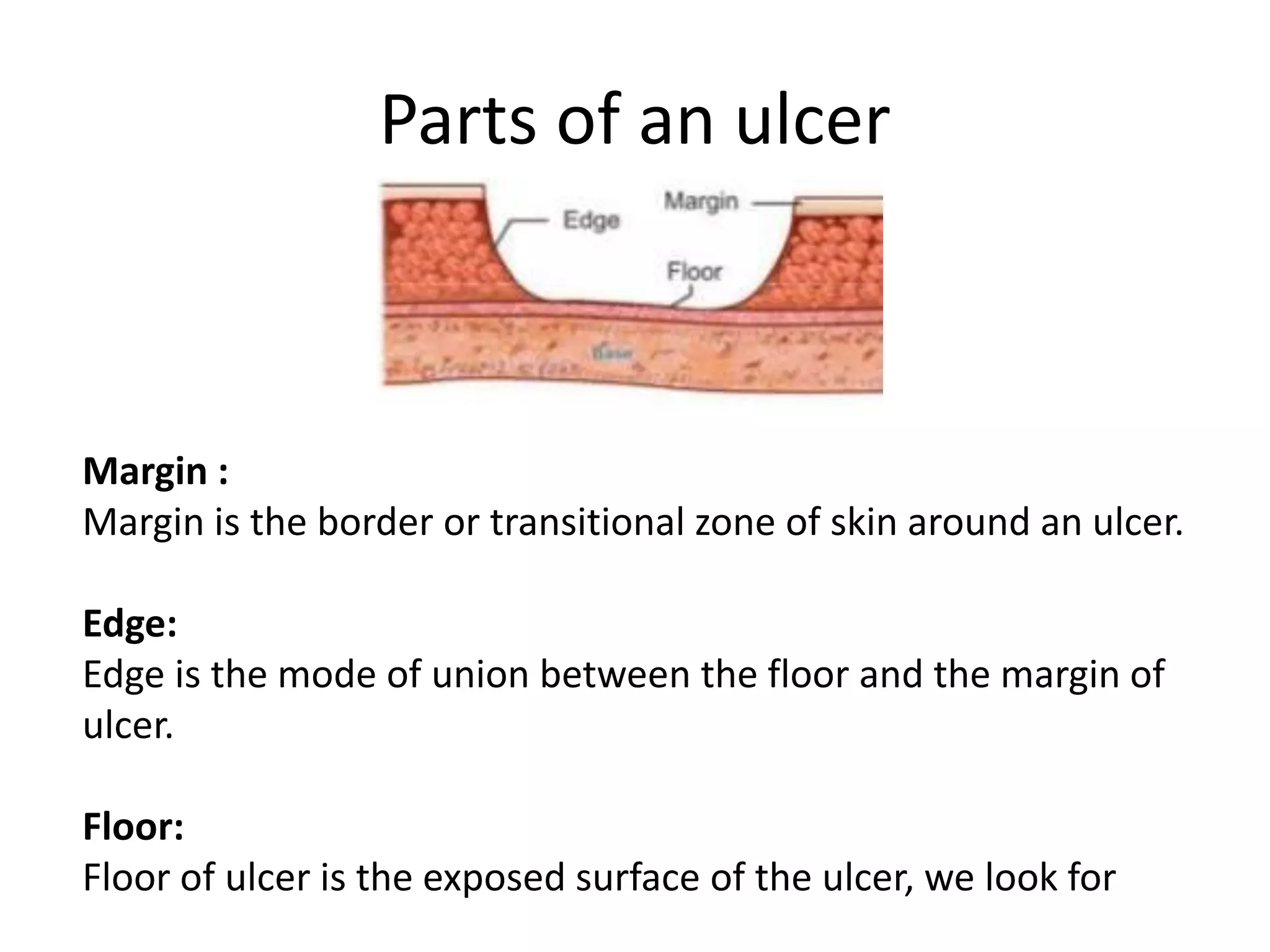 Solitary oral ulcers and systemic diseases | PPTX