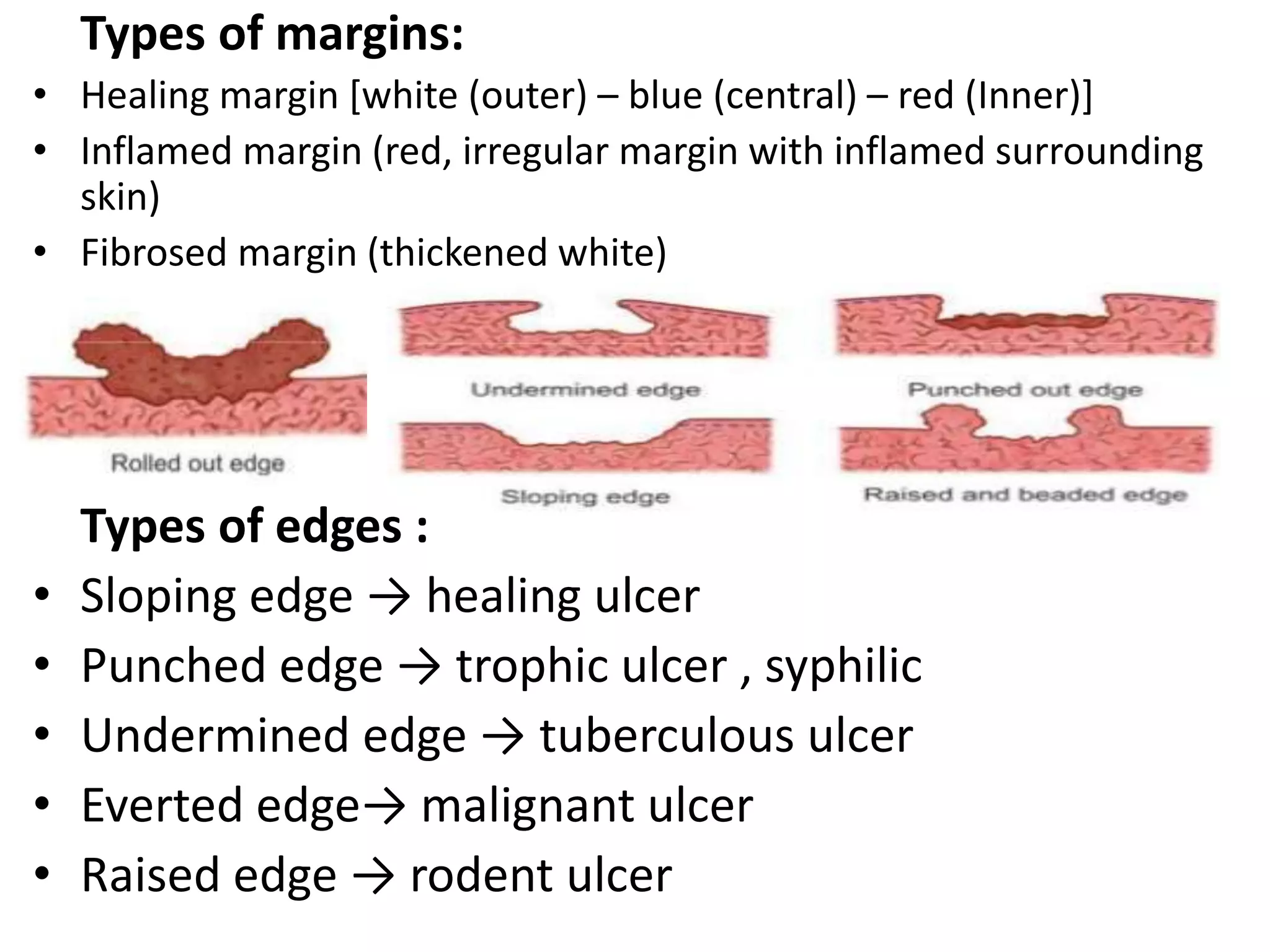 Solitary oral ulcers and systemic diseases | PPTX