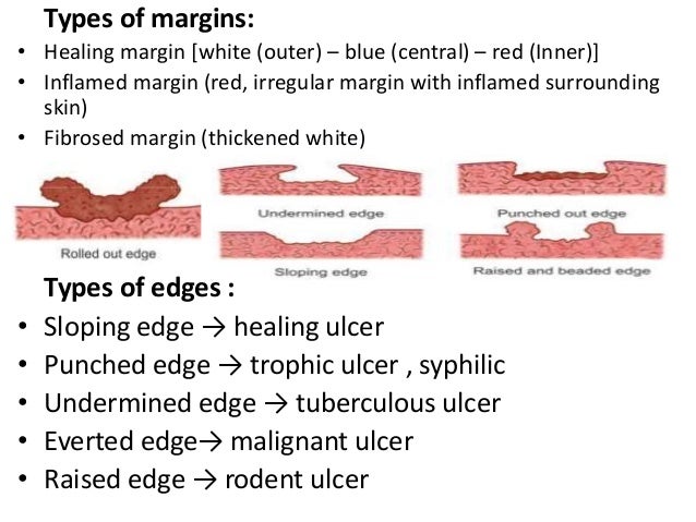 Solitary oral ulcers and systemic diseases