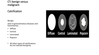 Solitary pulmonary nodule | PPTX