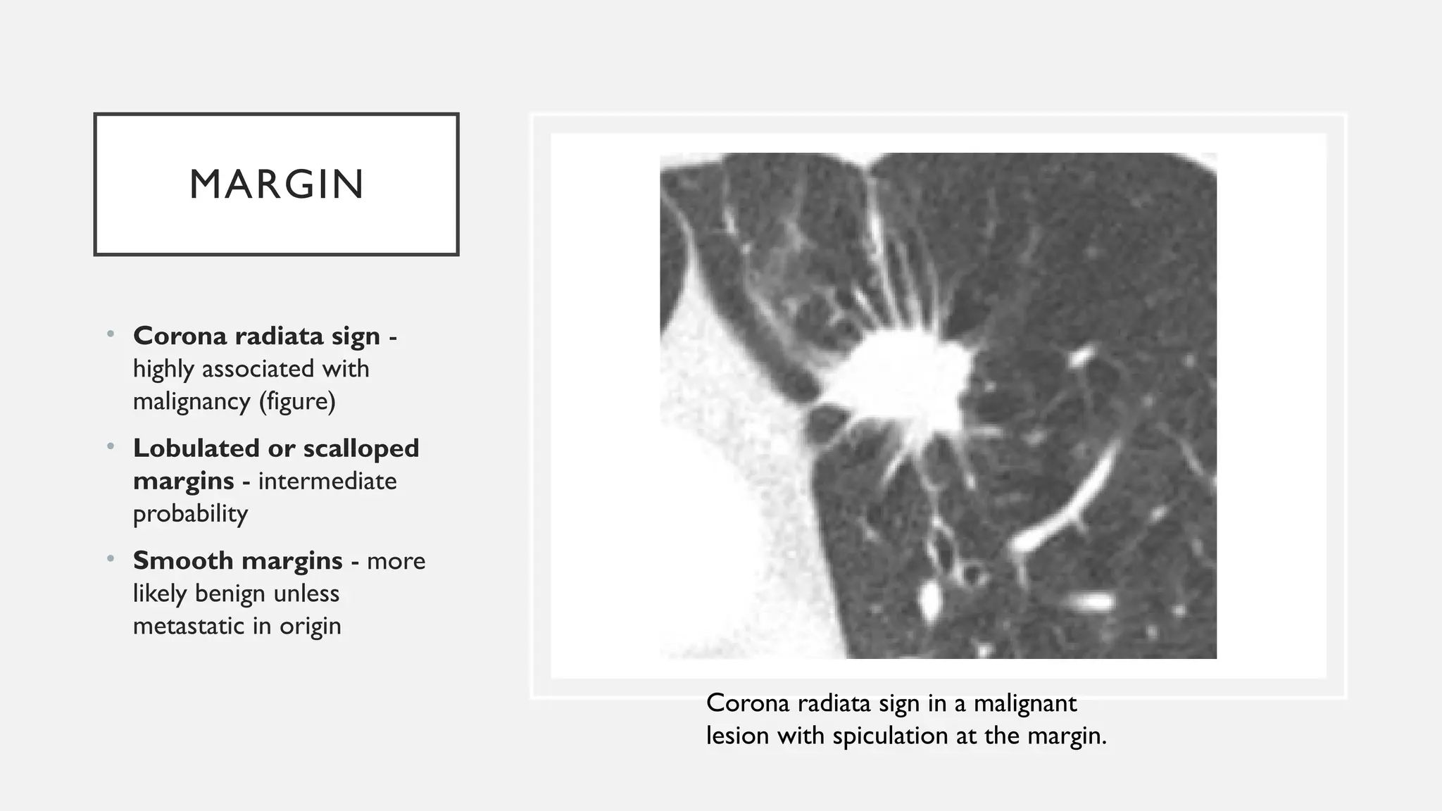 Understanding Solitary pulmonary nodules.pptx