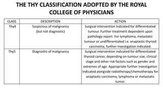 Solitary thyroid nodule | PPTX