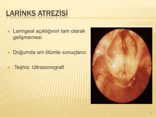 Solunum sistemi embriyolojisi | PPTX