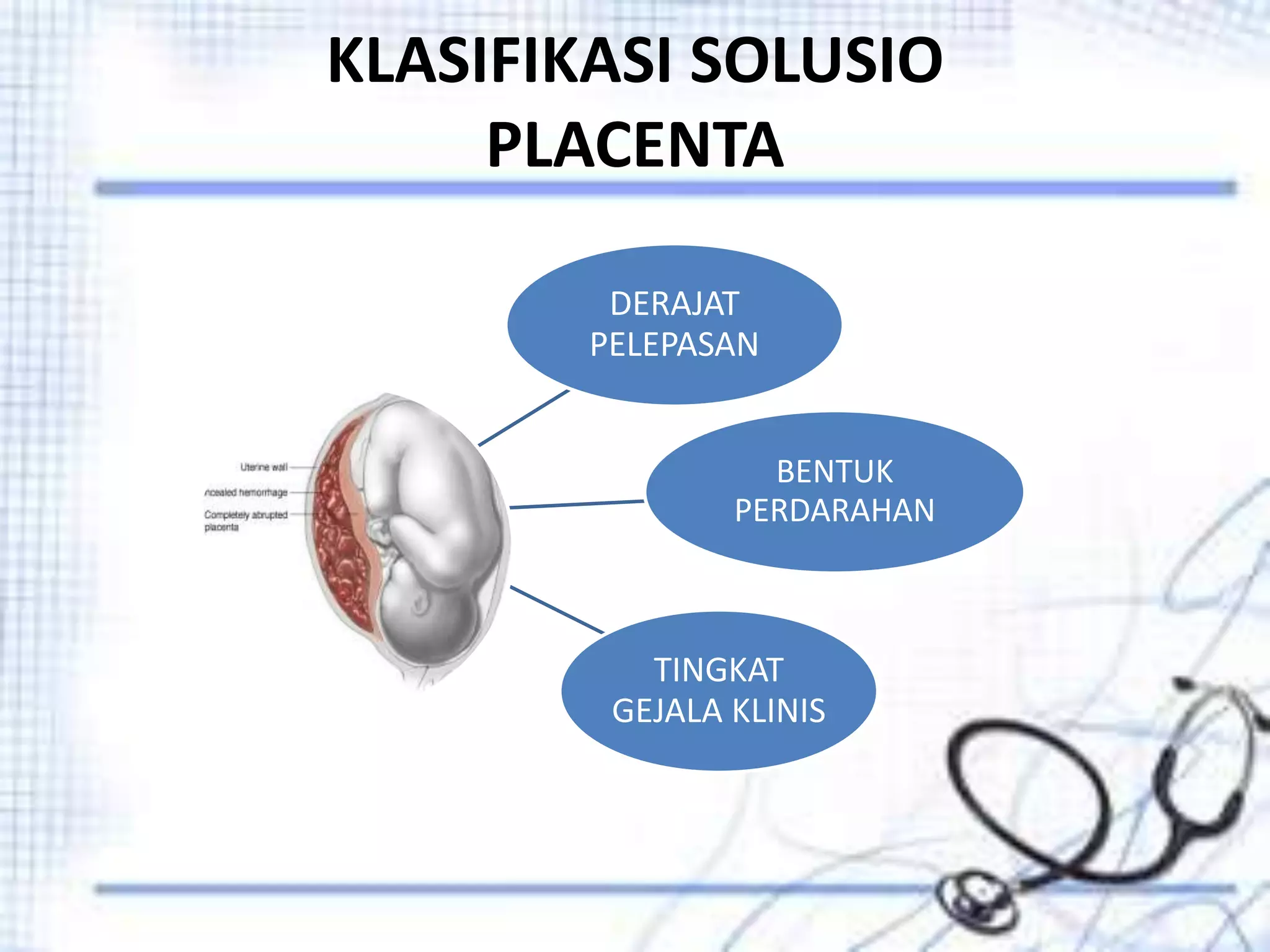 Solusio placenta | PPTX
