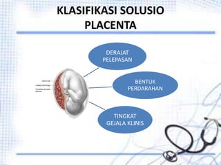 Solusio placenta | PPTX