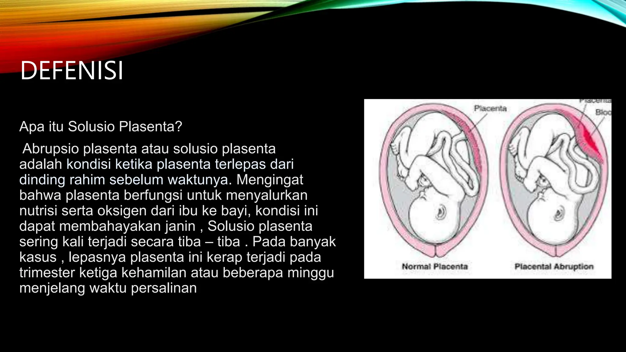 solusio plasenta.pptx bansnjakqjnnwjjwjjwjjsjsjsjjsj | PPTX