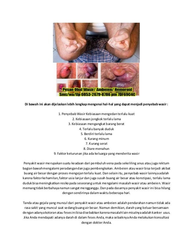 Solusi terbaik meringankan penyakit wasir ambeien