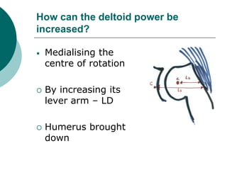 Solution to Rotator Cuff Deficient Shoulder.ppt