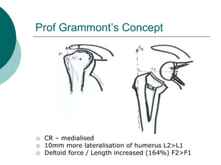 Solution to Rotator Cuff Deficient Shoulder.ppt