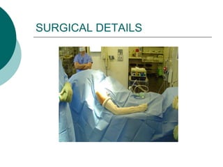 Solution to Rotator Cuff Deficient Shoulder.ppt
