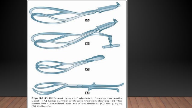 SOLWEZI GENERAL HOSPITAL assisted vaginal delivery.pdf