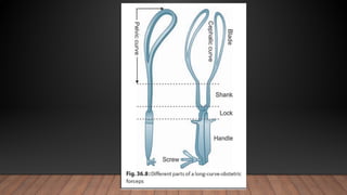 SOLWEZI GENERAL HOSPITAL assisted vaginal delivery.pdf