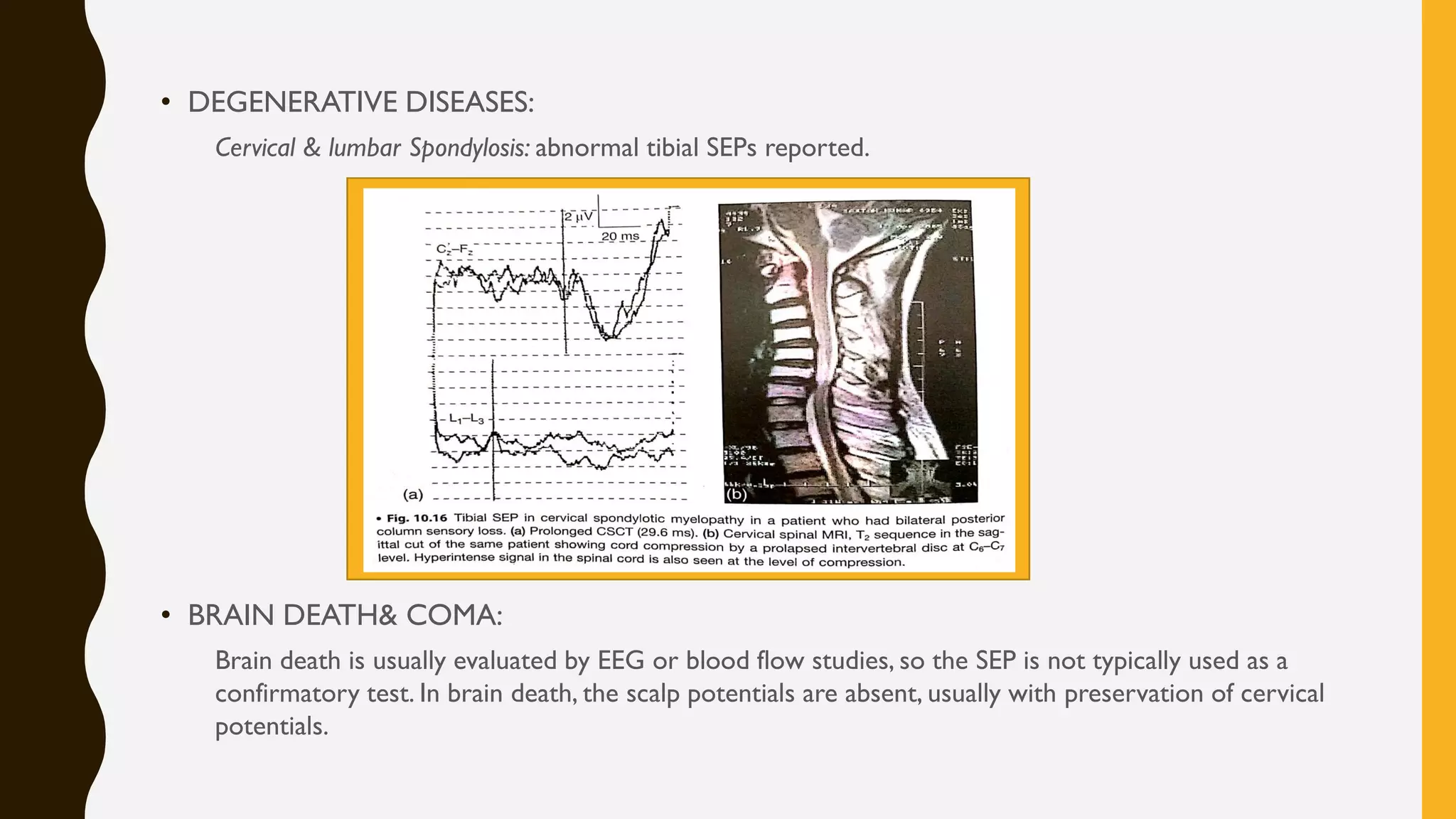 Somatosensory and motor evoked potentials by neelothpala | PDF